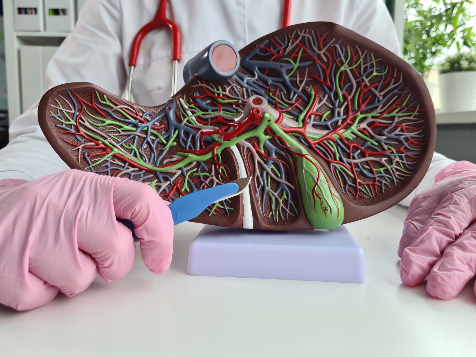 Weight Loss After Gallbladder Removal - Bmi Doctors