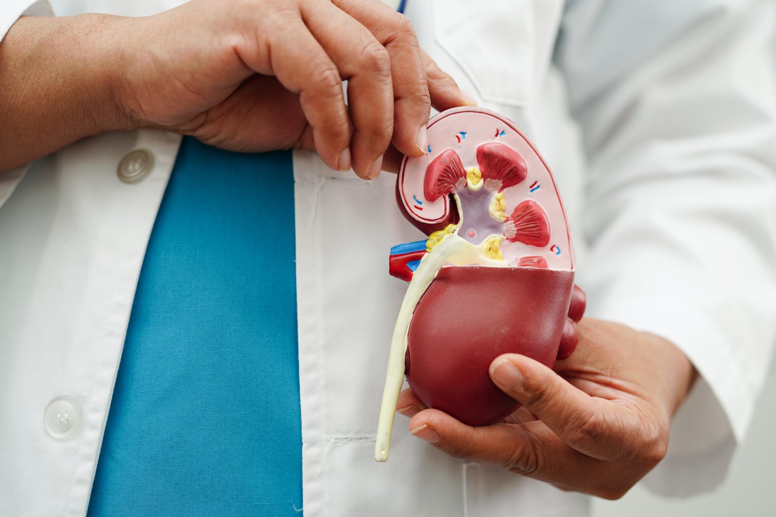 Effective Weight Loss Strategies for Kidney Disease Patients: A ...