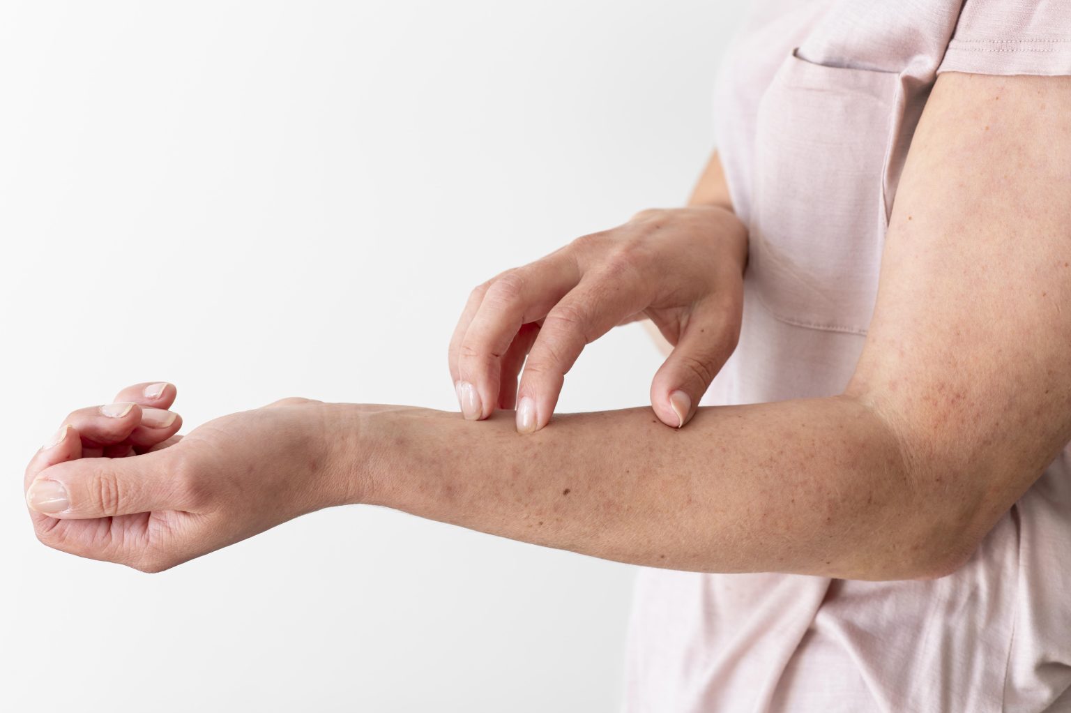 Managing Psoriasis with Semaglutide: An In-Depth Guide for Effective ...